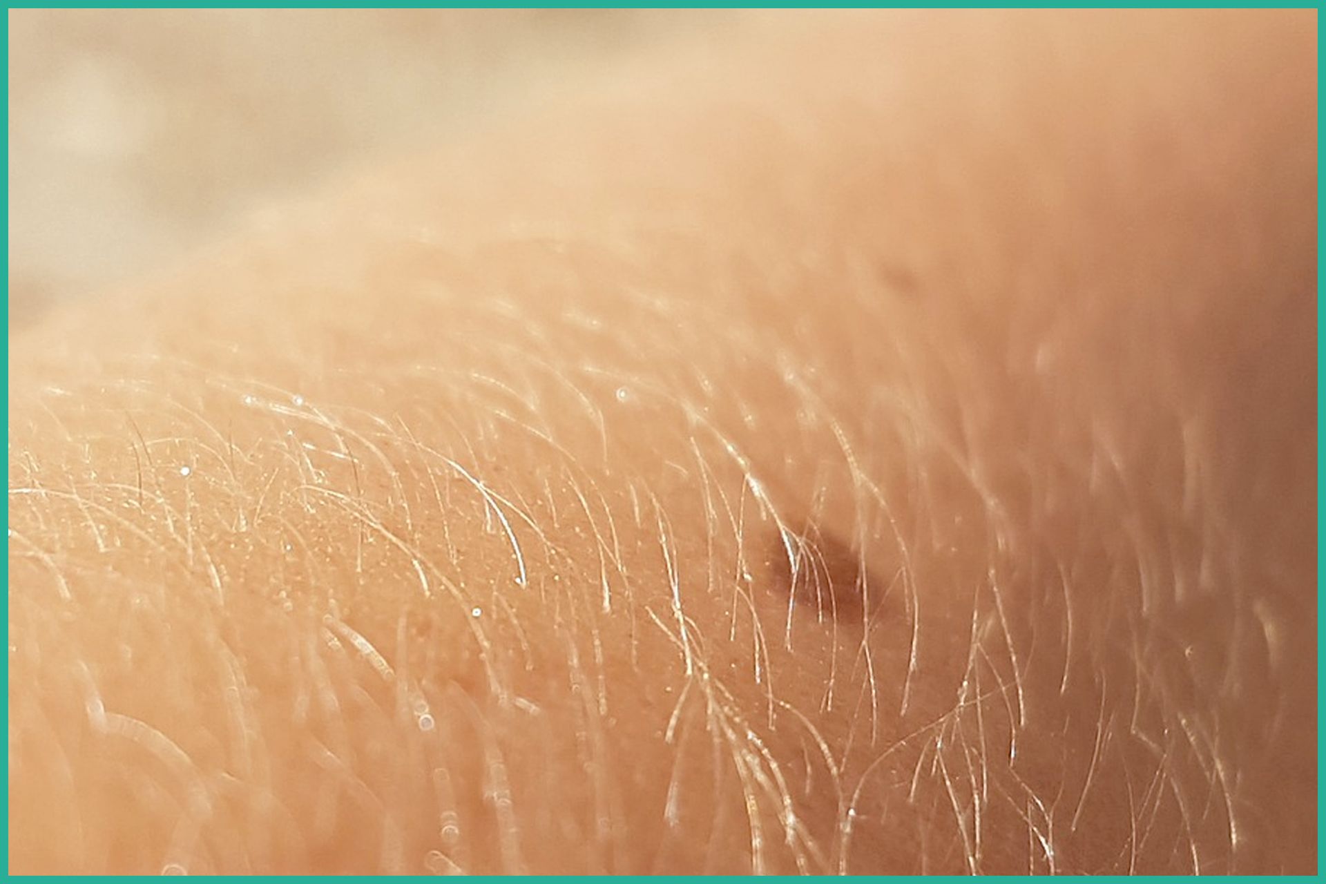 Mountain Pine Dermatology: Dermatologists in Meridian, ID