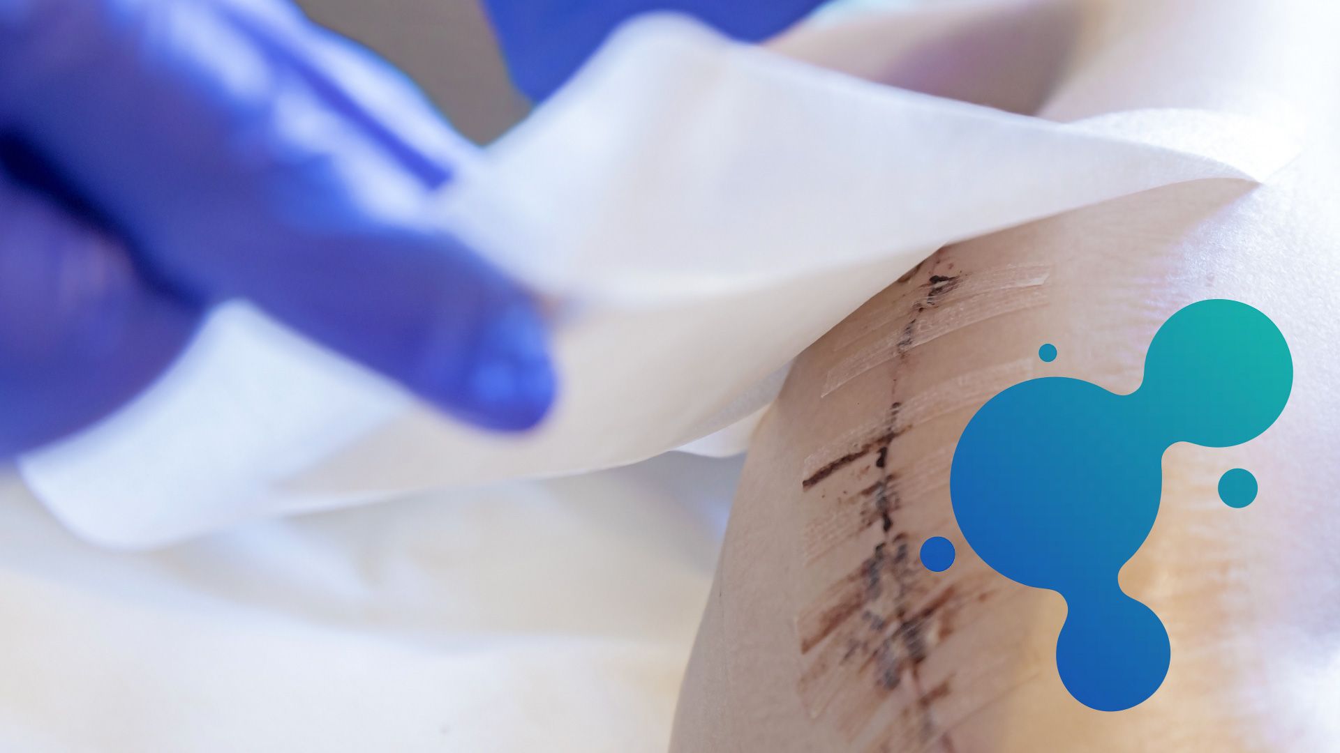 Wound Care Services | Fusion Biologics Amniotic Skin Grafts