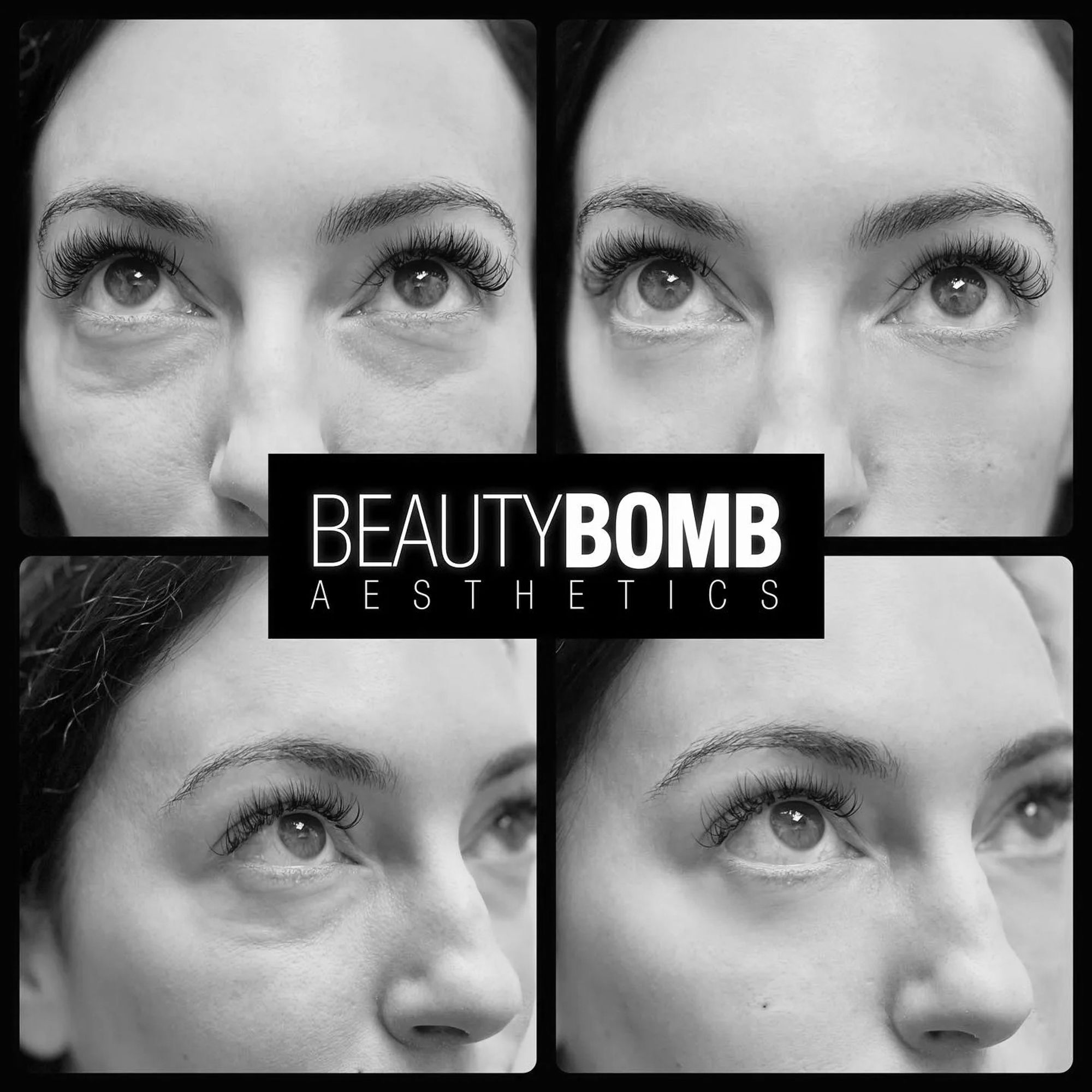 Medical Spa & Botox in Smithtown, NY - Beauty Bomb Aesthetics